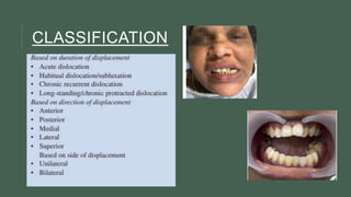condylar dislocation- etiopathogenesis & treatment | PPTX
