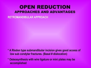 Condylar fracture | PPT