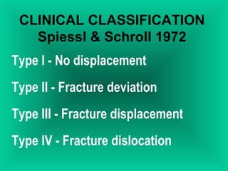 Condylar fracture | PPT