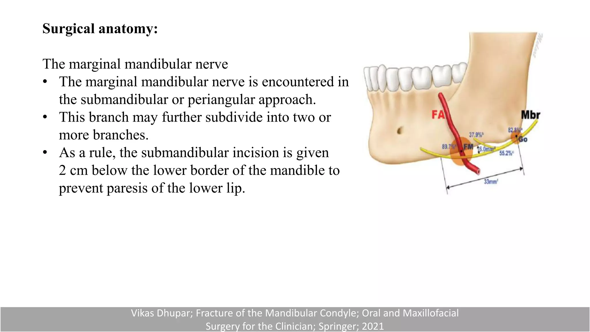 Condylar fracture.pptx