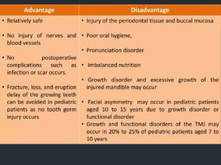 maxillofacia truma. managment of condylar fracture | PPTX