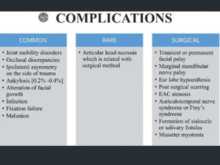 maxillofacia truma. managment of condylar fracture | PPTX