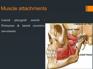 maxillofacia truma. managment of condylar fracture | PPTX