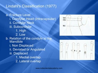 Condylar fractures /certified fixed orthodontic courses by Indian ...