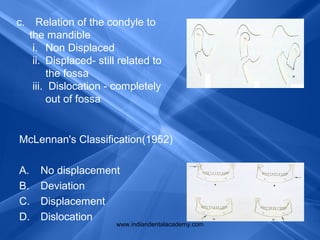 Condylar fractures /certified fixed orthodontic courses by Indian ...