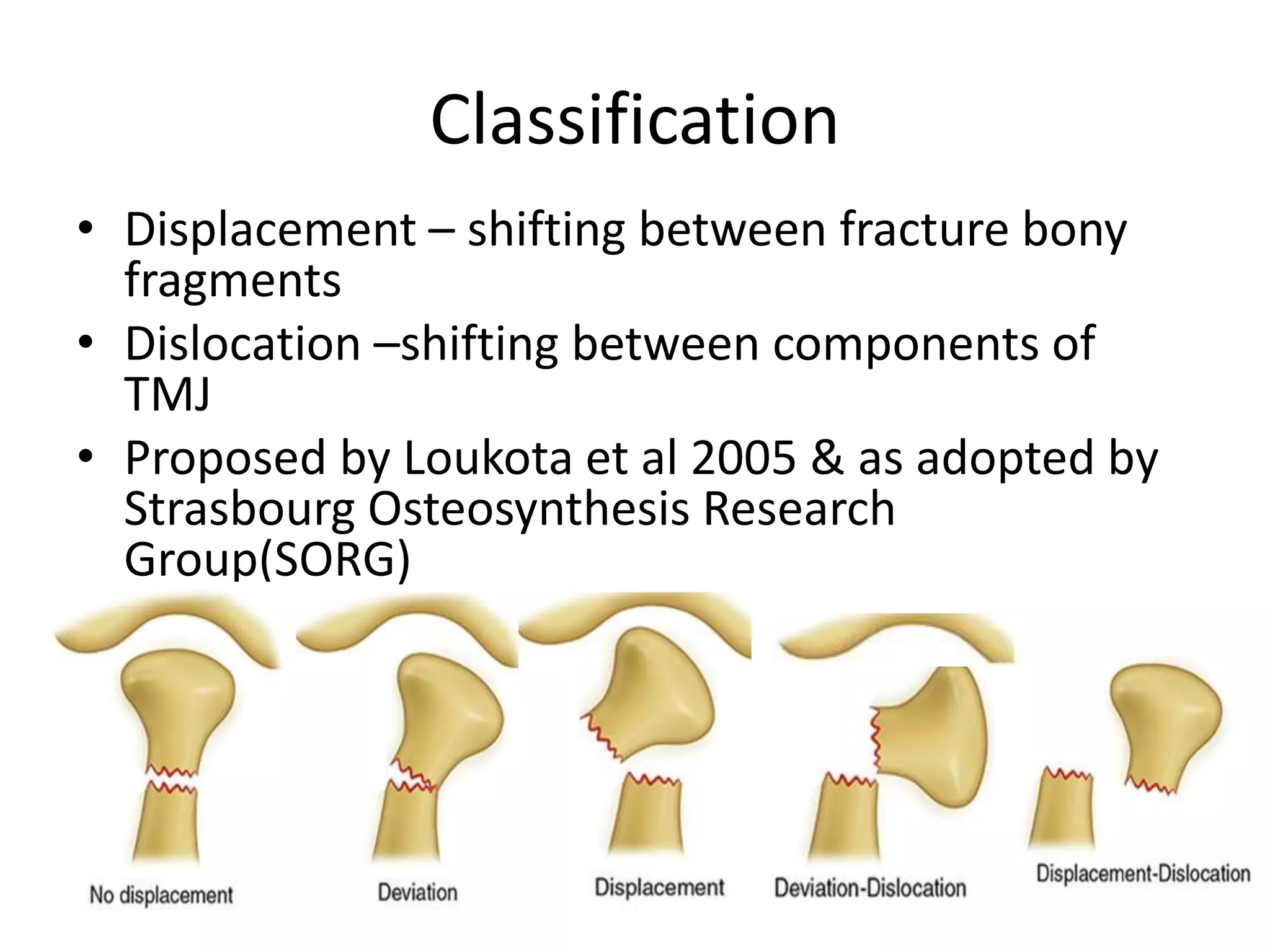 Mandibular Condylar fractures & its Management | PPTX