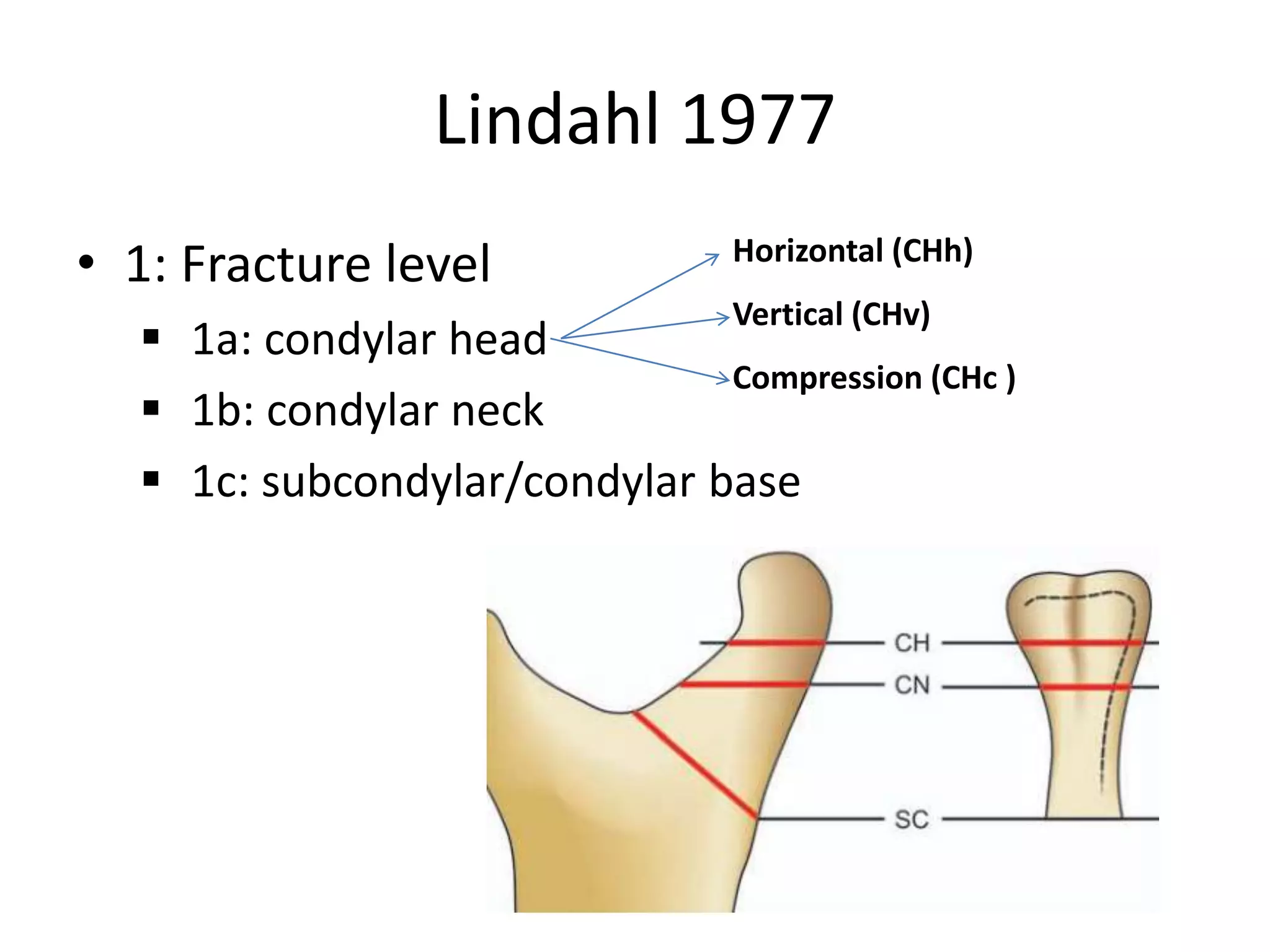 Mandibular Condylar fractures & its Management | PPTX