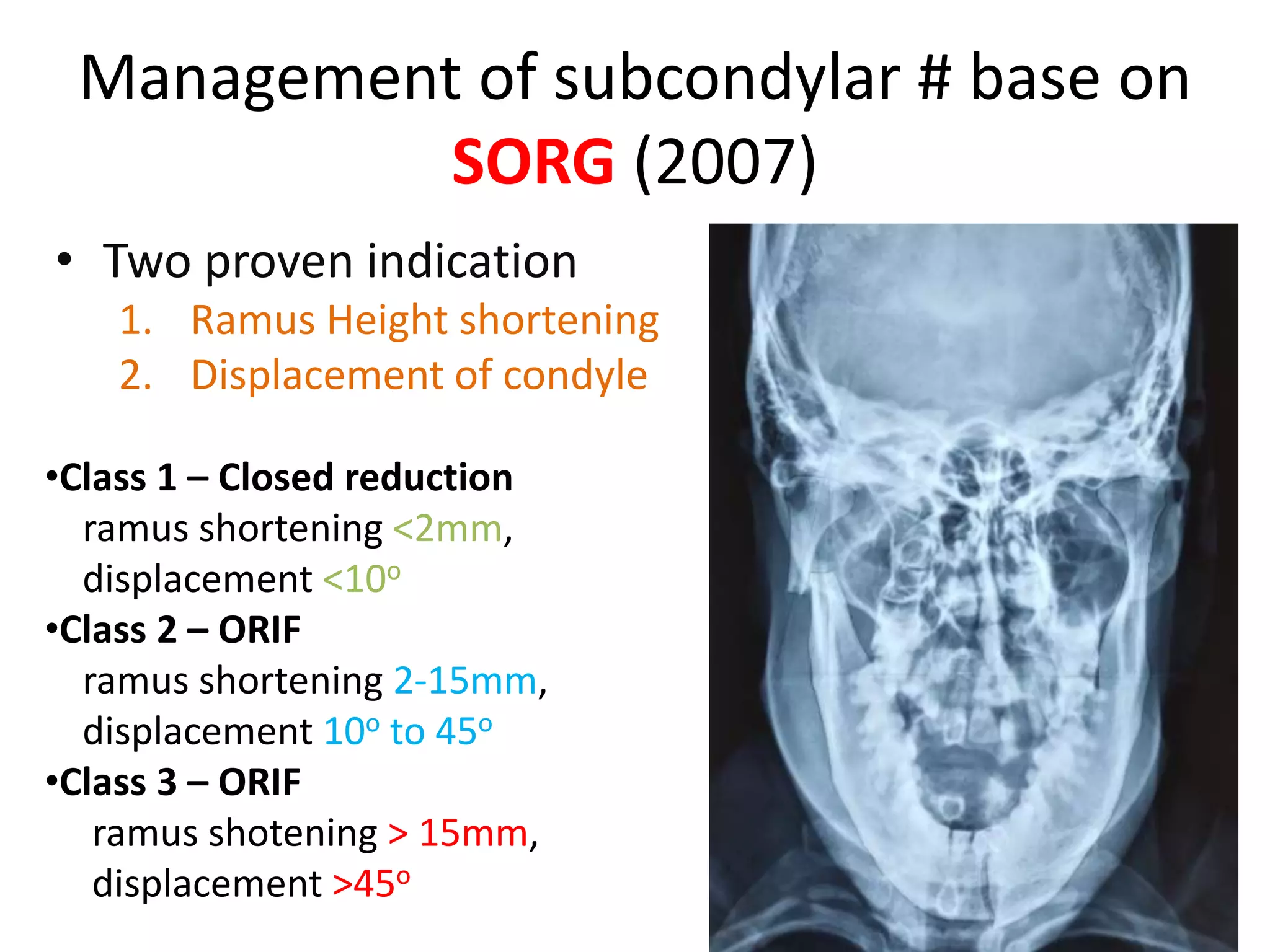 Mandibular Condylar fractures & its Management | PPTX