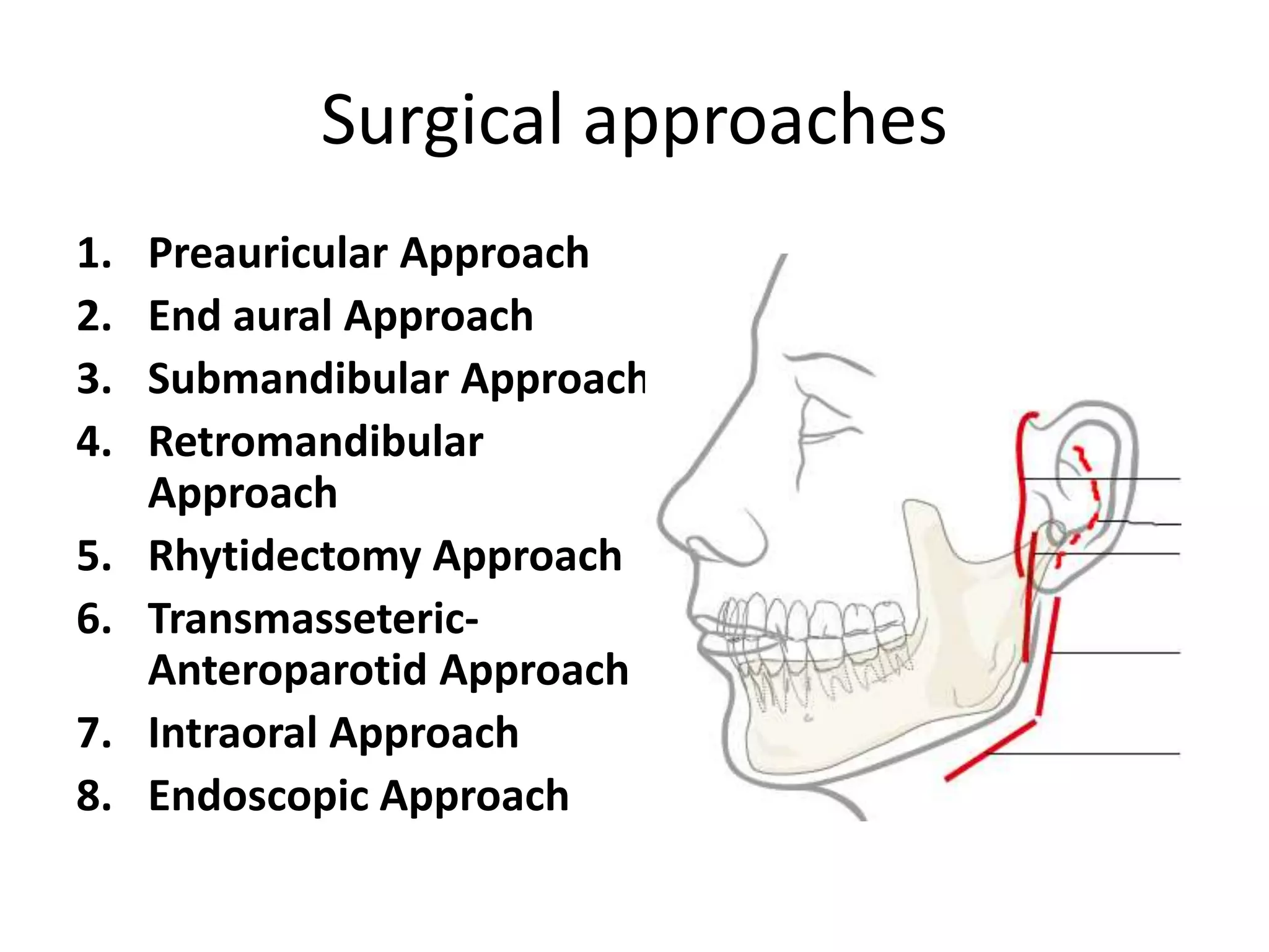 Mandibular Condylar fractures & its Management | PPTX
