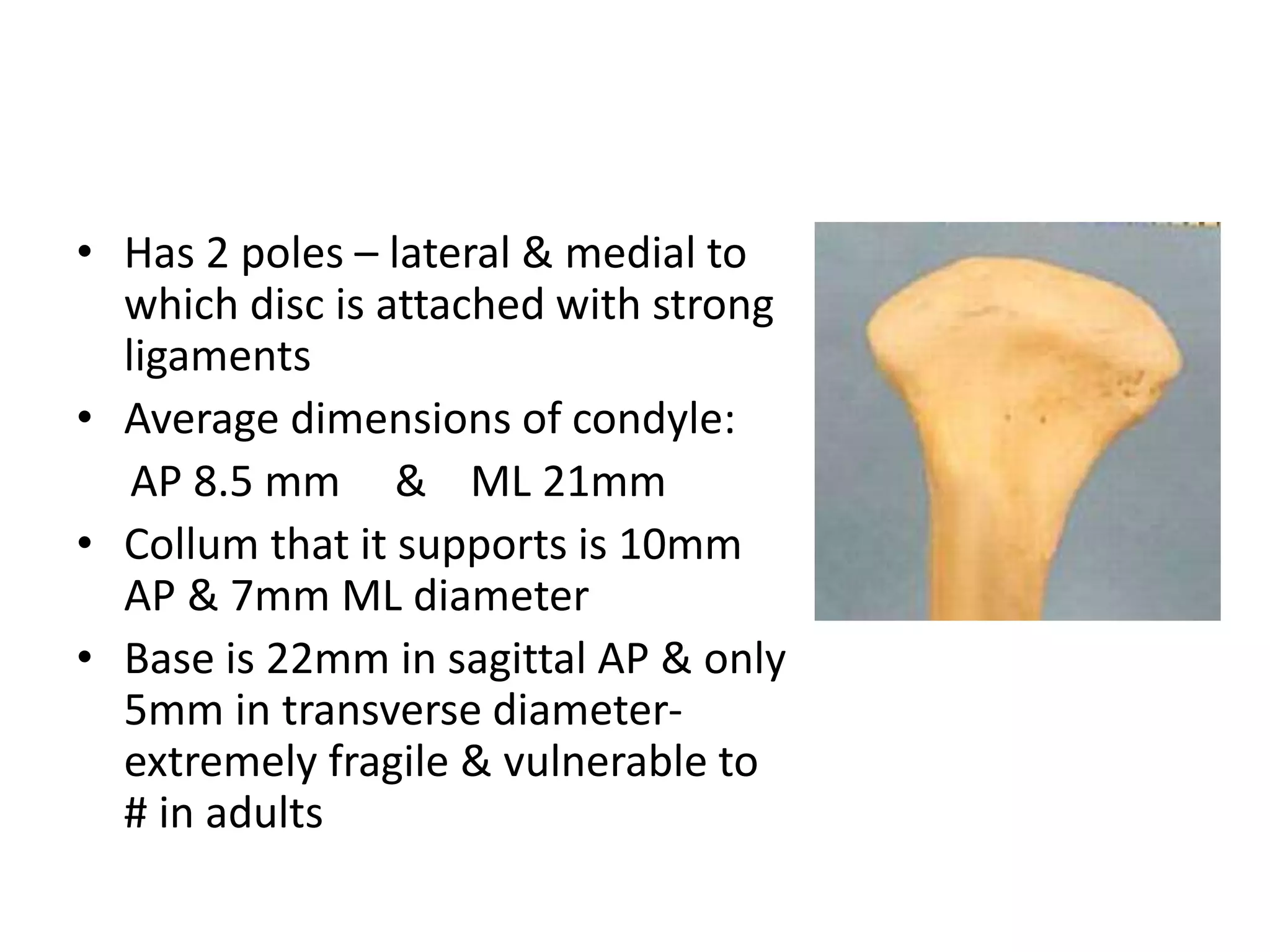 Mandibular Condylar fractures & its Management | PPTX