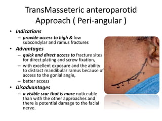 Mandibular Condylar fractures & its Management | PPT