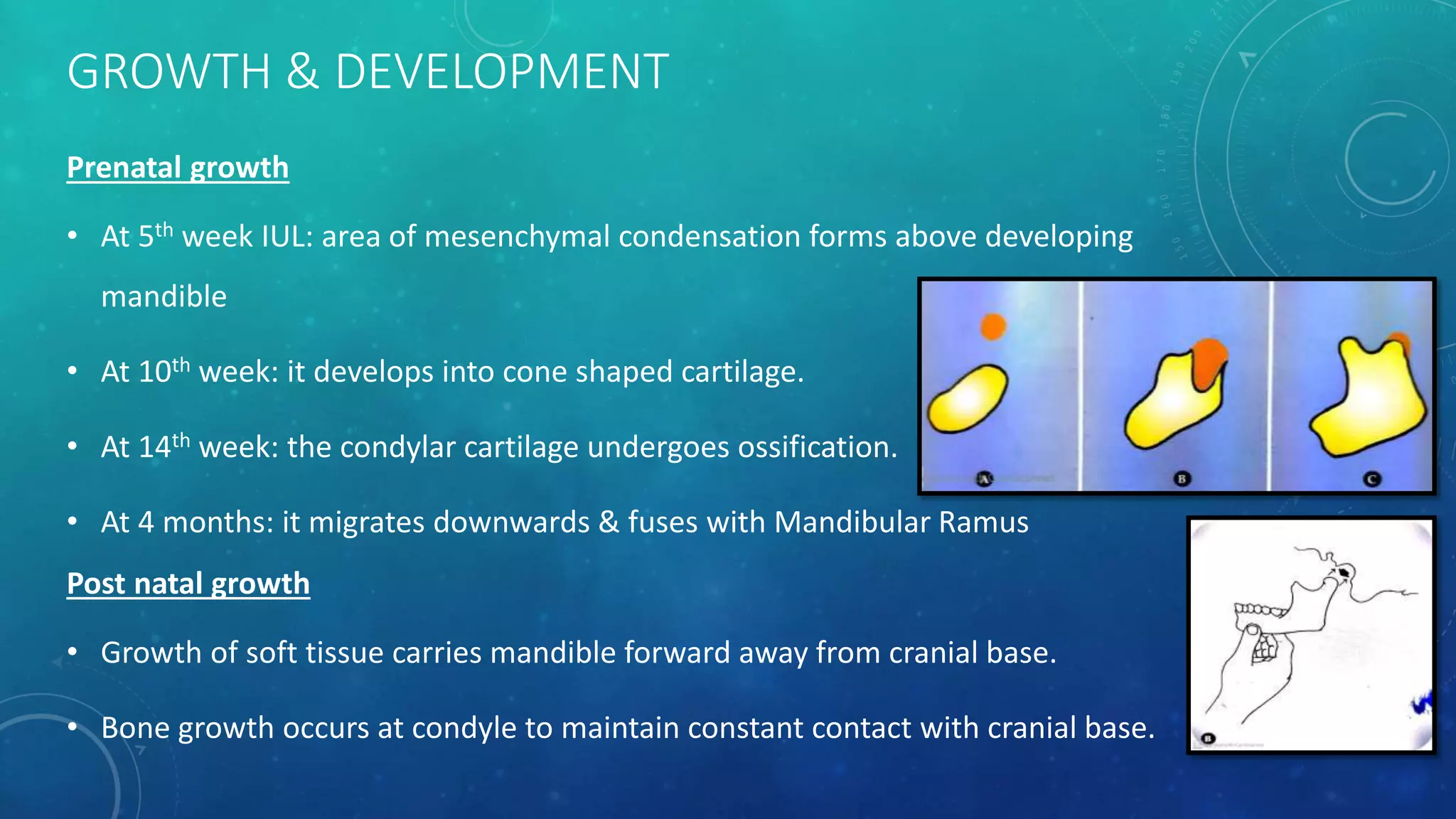 Condylar fractures | PPTX