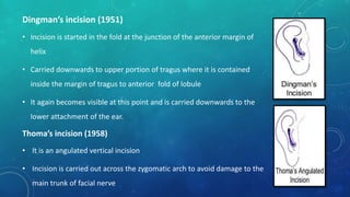Condylar fractures | PPTX