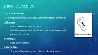 Condylar fractures | PPTX