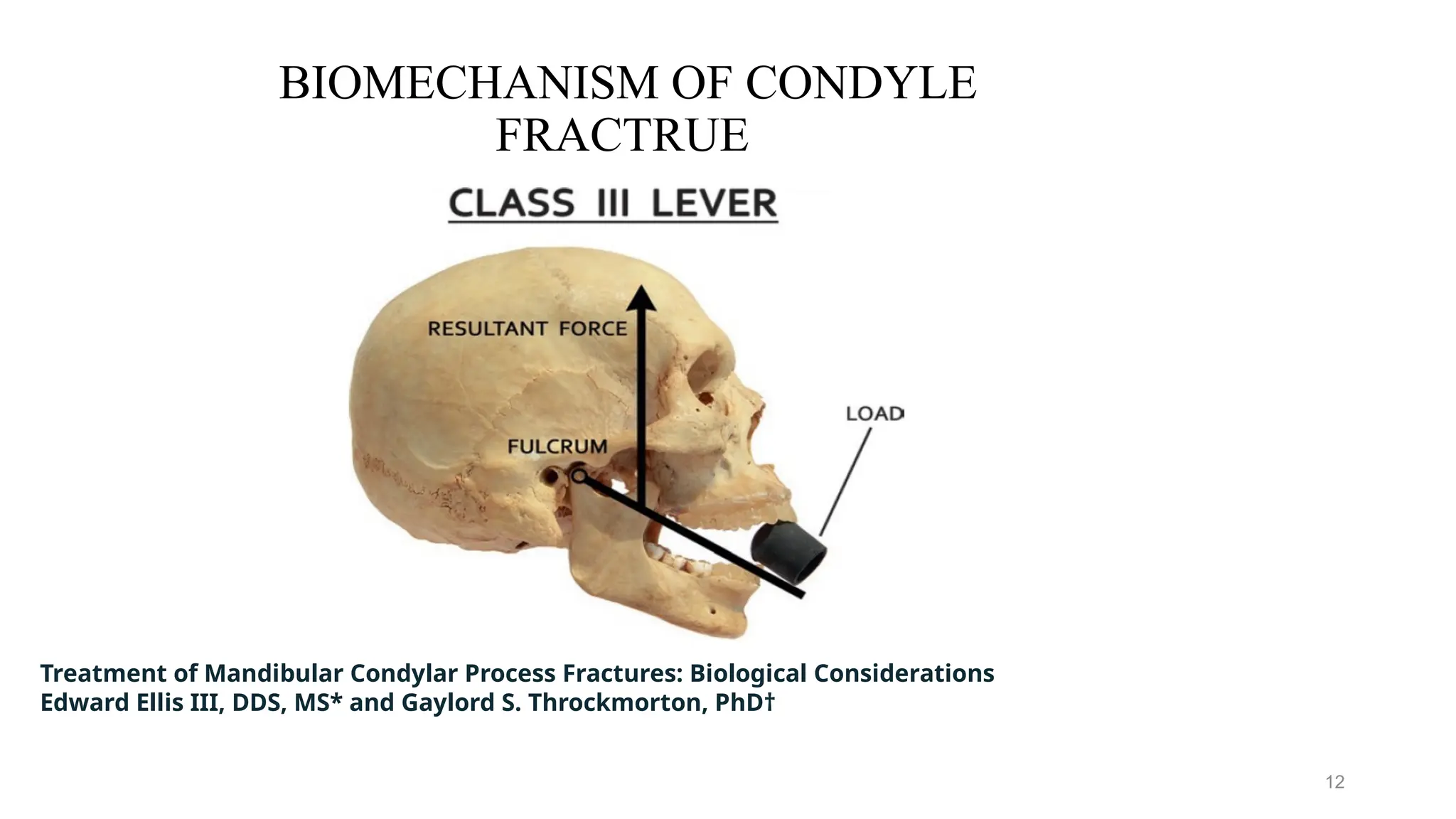 CONDYLAR FRACTURES AND ITS MANAGEMENT.pptx