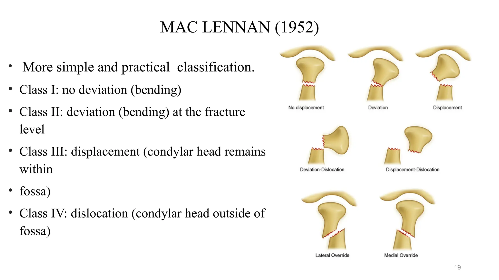 CONDYLAR FRACTURES AND ITS MANAGEMENT.pptx
