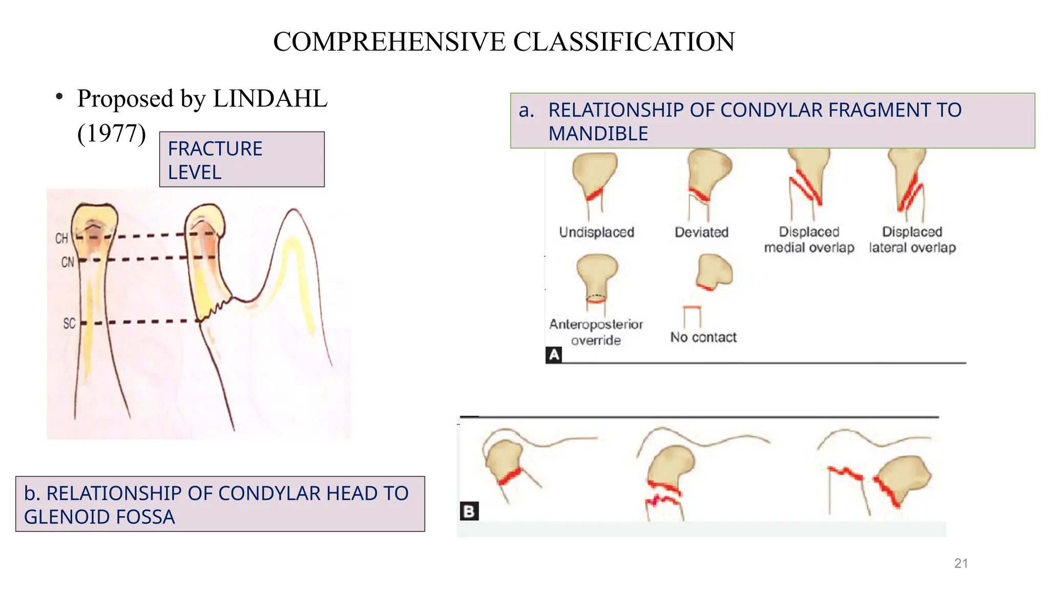 CONDYLAR FRACTURES AND ITS MANAGEMENT.pptx