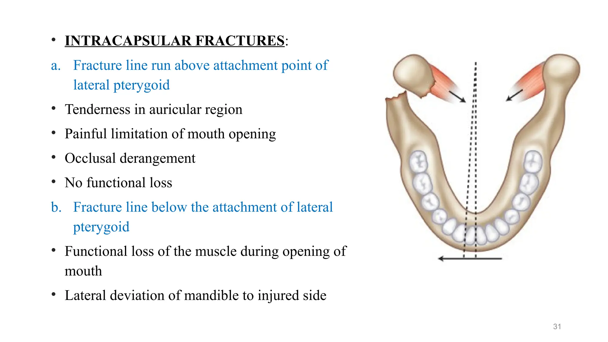 CONDYLAR FRACTURES AND ITS MANAGEMENT.pptx