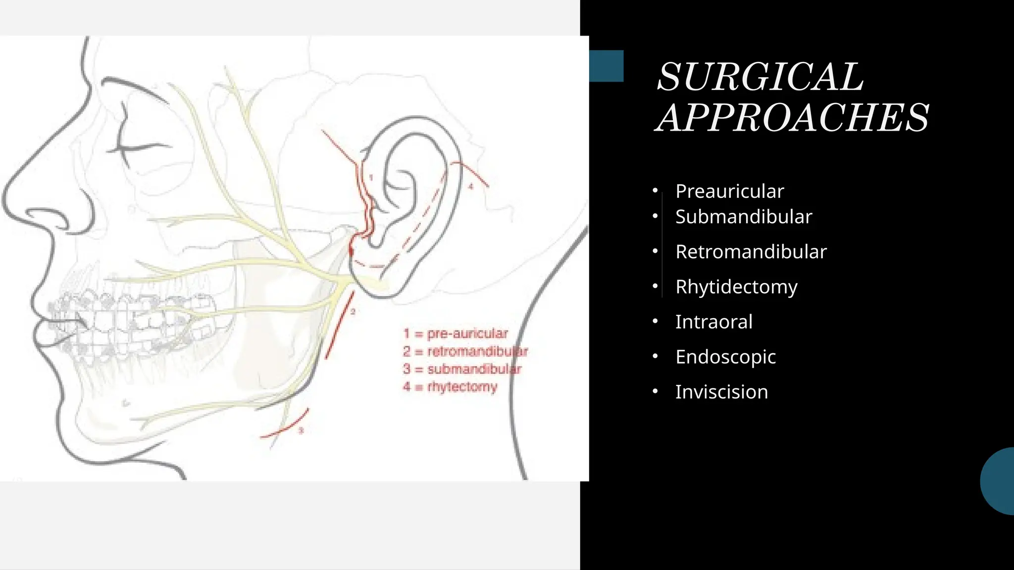 CONDYLAR FRACTURES AND ITS MANAGEMENT.pptx