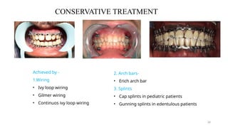 CONDYLAR FRACTURES AND ITS MANAGEMENT.pptx