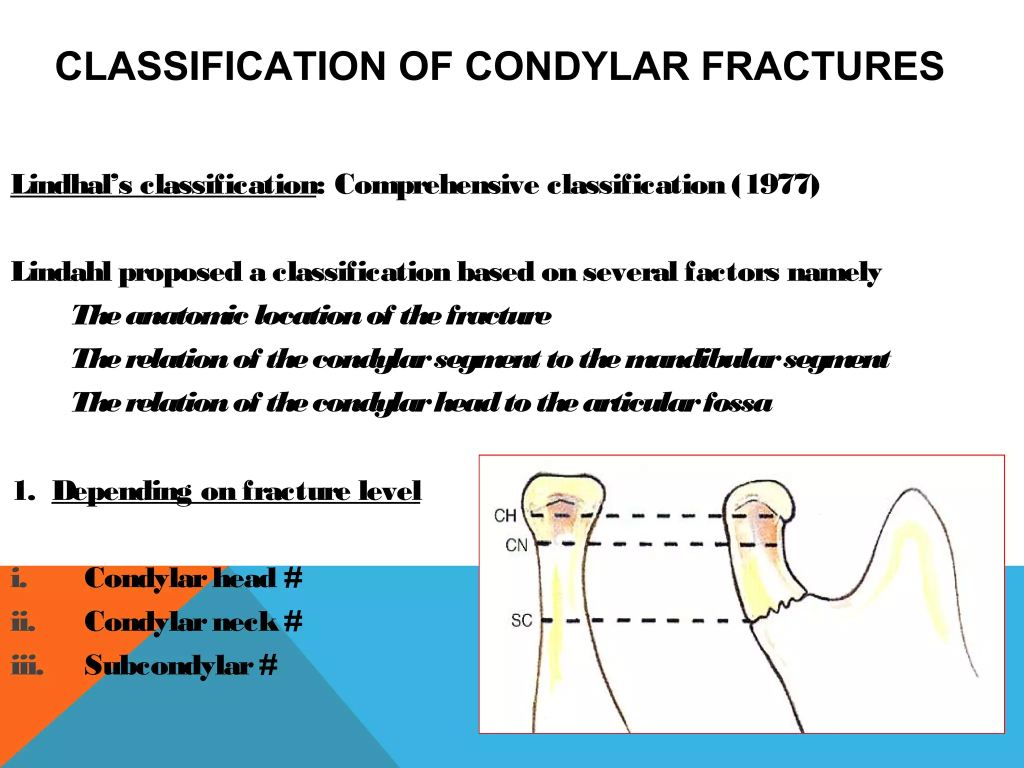 Condylar fractures | PPT