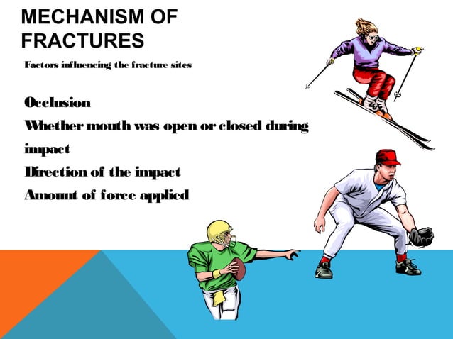 Condylar Fractures Ppt