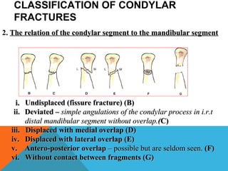 Condylar fractures | PPT