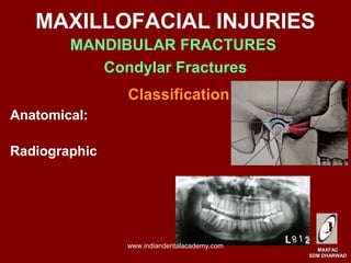Condylar fractures /certified fixed orthodontic courses by Indian ...
