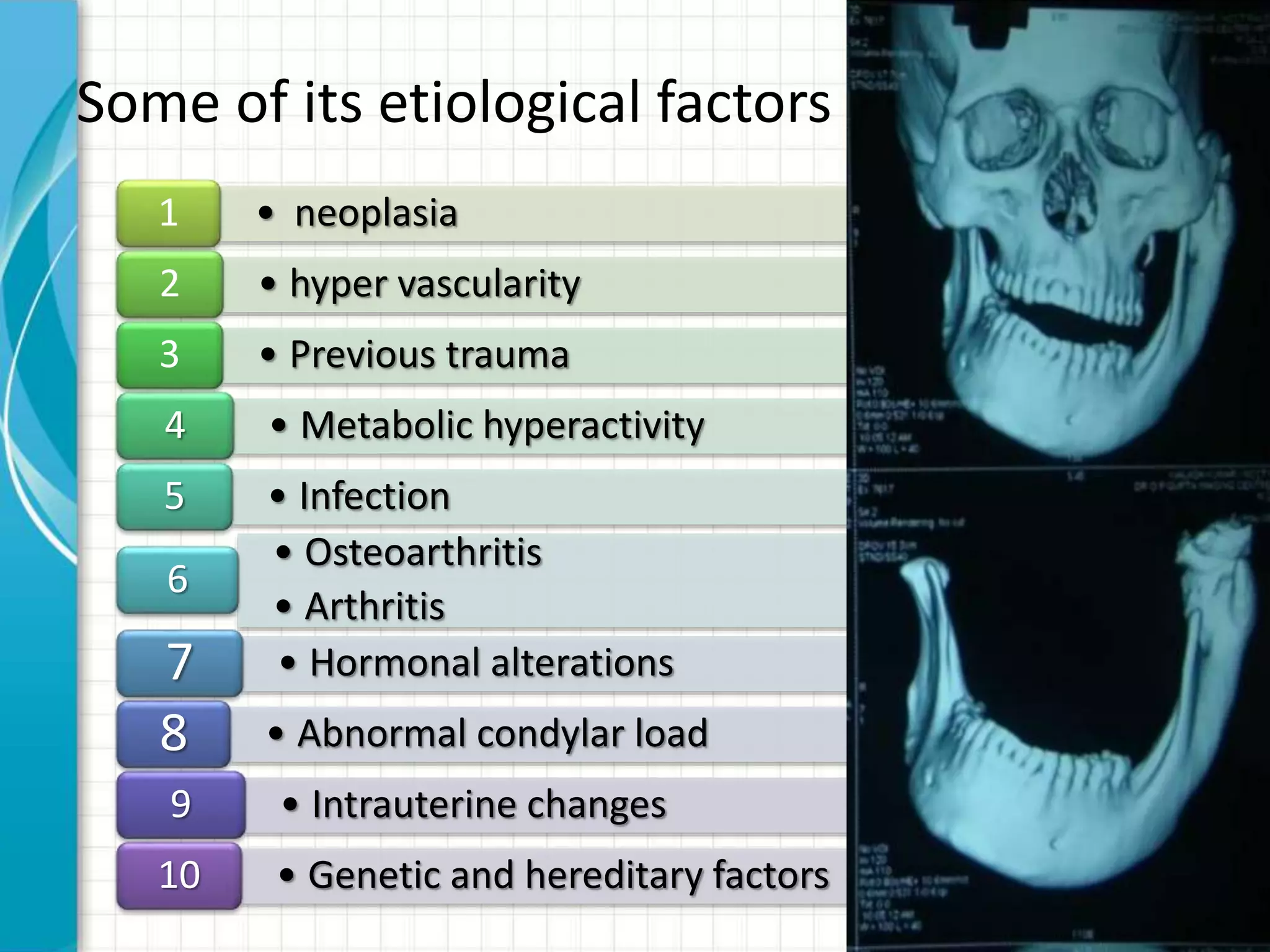Condylar hyperplasia by DR SOONHAN ABDULLAH AND DR SALMAN SHAMS (MSc ...