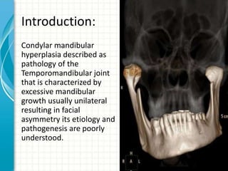 Condylar hyperplasia by DR SOONHAN ABDULLAH AND DR SALMAN SHAMS (MSc ...