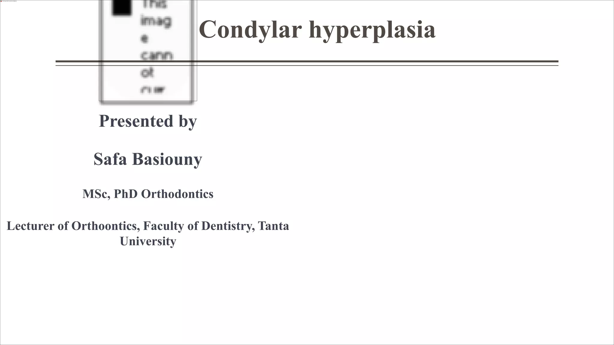 Condylar Hyperplasia and Othodontics.pptx
