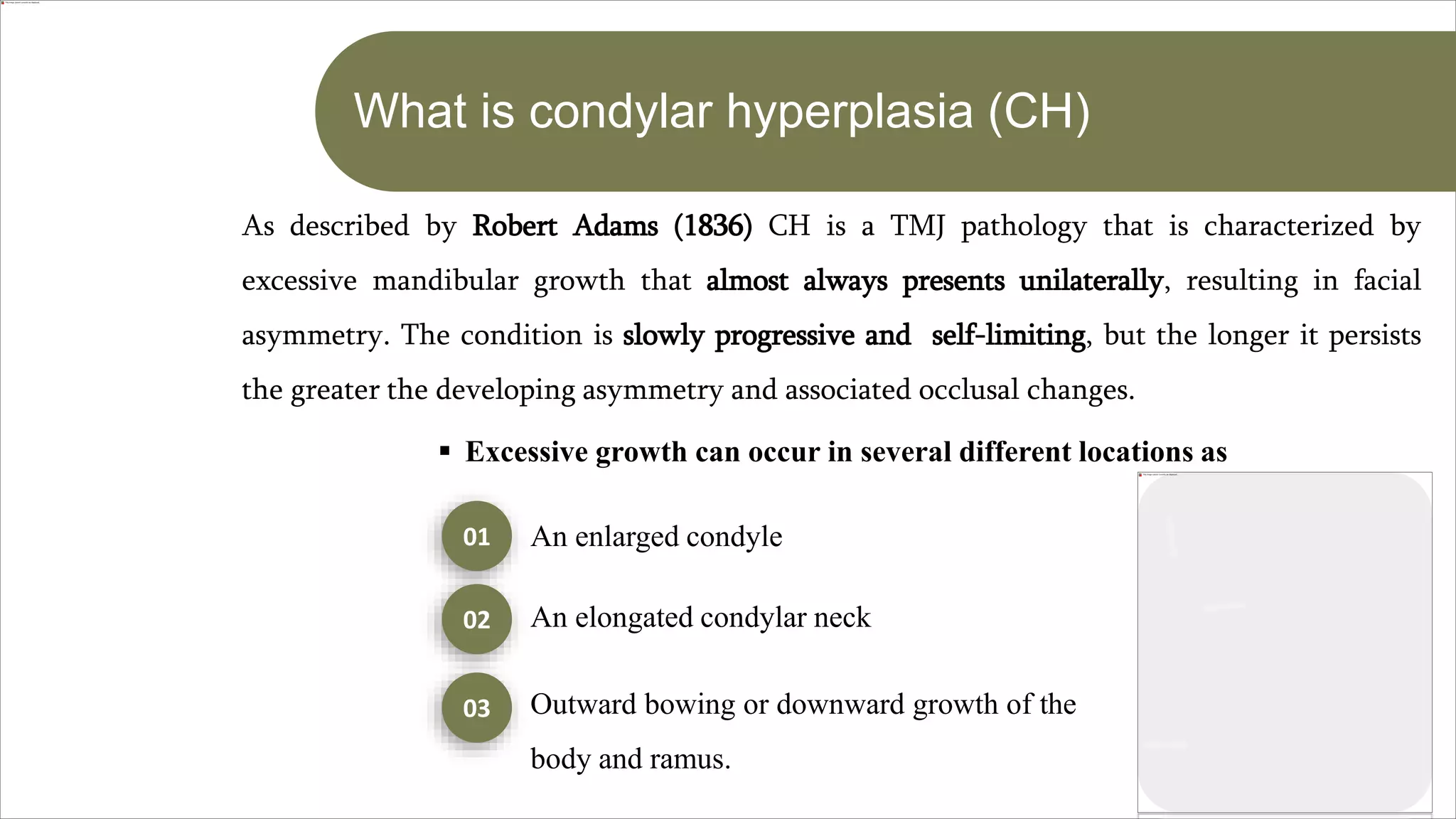 Condylar Hyperplasia and Othodontics.pptx