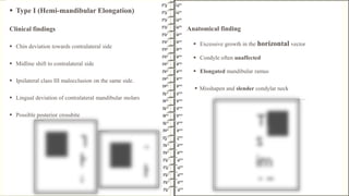 Condylar Hyperplasia and Othodontics.pptx