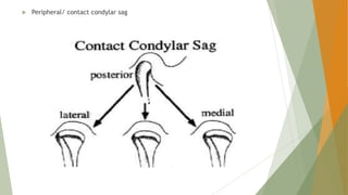 Condylar resorption | PPTX