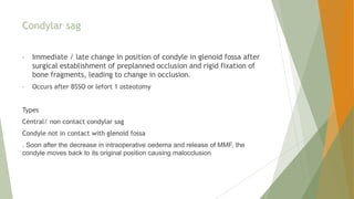 Condylar resorption | PPTX