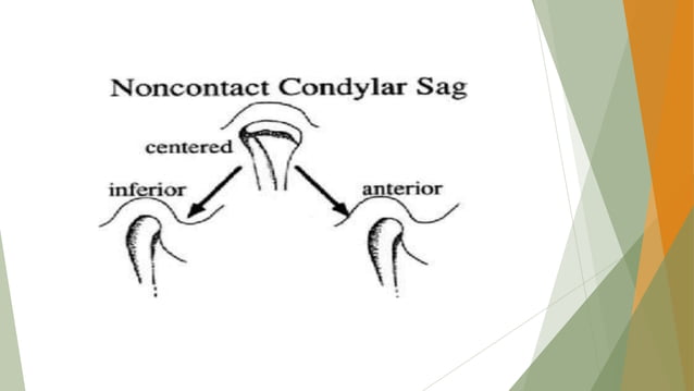 Condylar resorption | PPT