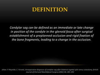 Condylar sag | PPTX