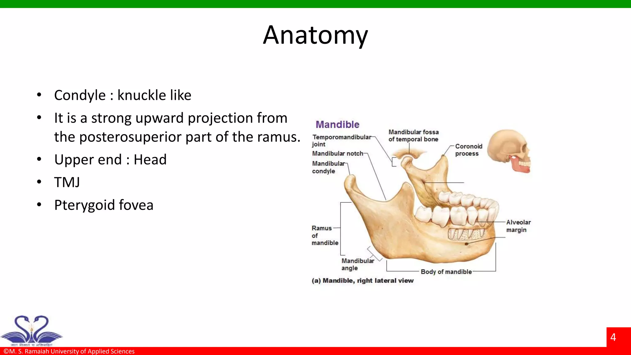 Condylar fractures | PPTX