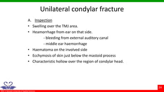 Condylar fractures | PPTX