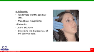 Condylar fractures | PPTX