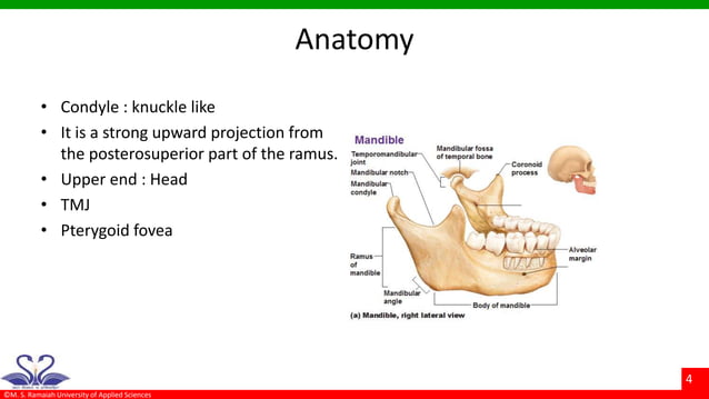 Condylar fractures | PPTX
