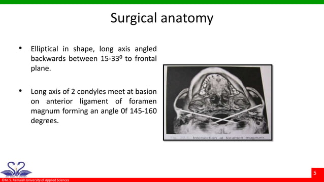 Condylar fractures | PPTX