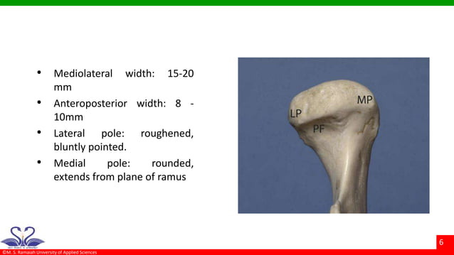 Condylar fractures | PPTX