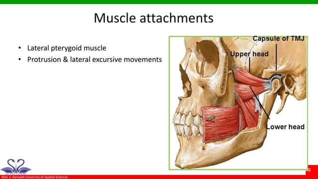 Condylar fractures | PPTX