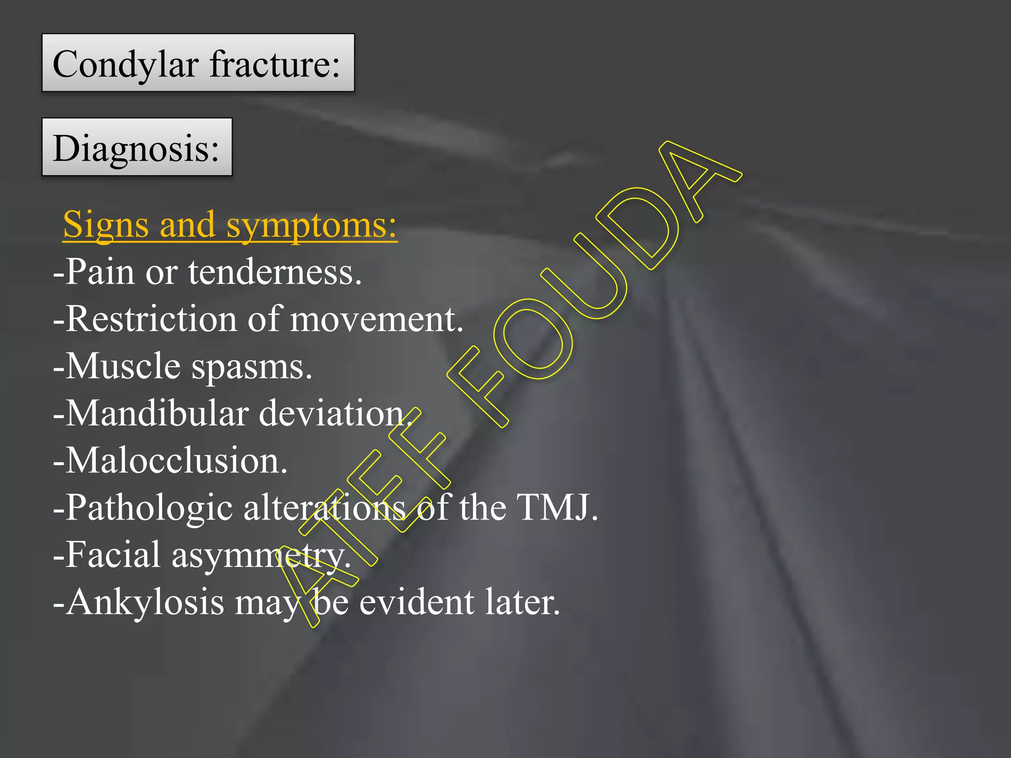 Condyle fracture | PPSX