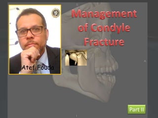 Condyle fracture | PPT