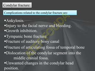 Condyle fracture | PPT