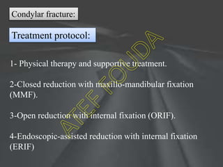 Condyle fracture | PPSX