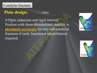 Condyle fracture | PPT