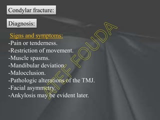 Condyle fracture | PPT